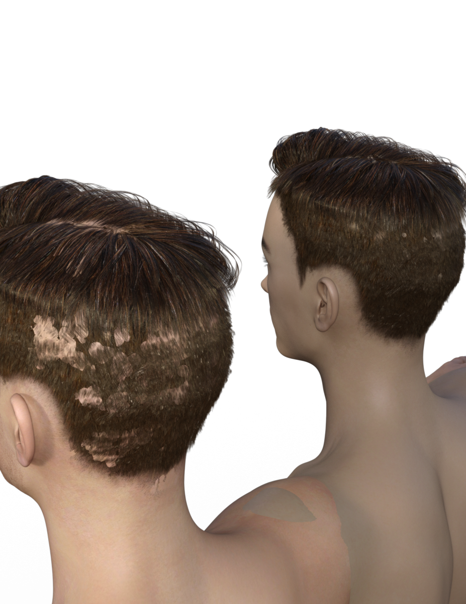 Action Guy Hair Leprosy - Daz 3D Forums