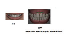 Morphs for g3f's teeth - Daz 3D Forums